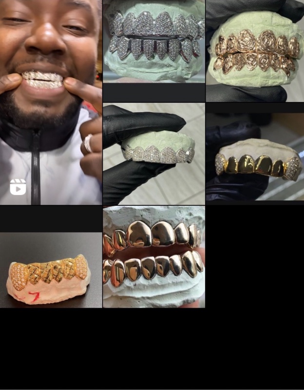 Custom Gold Grill 🔥 | Raffle Creator